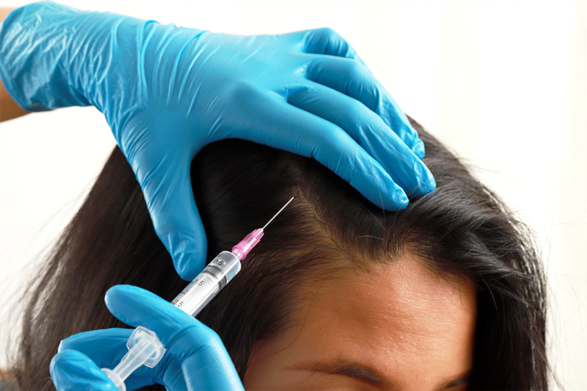 Revitalize Your Hair with PRP Therapy: The Future of Hair Restoration